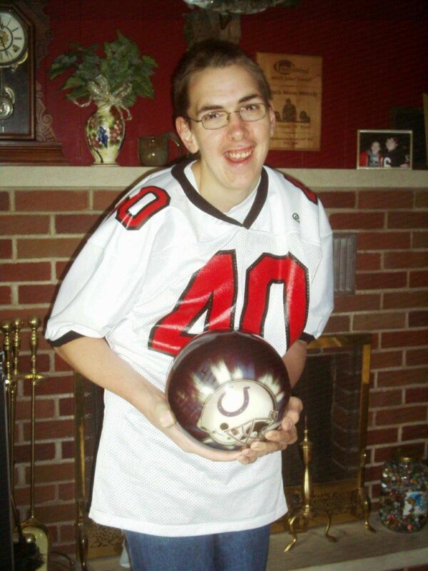 Sotos Syndrome - SSSA